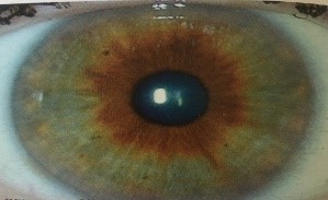 L’alimentation en fonction de la couleur de l’iris – Naturopathe Lyon ...